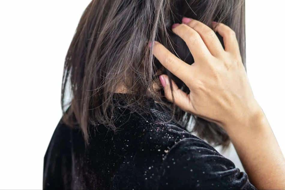 Por que é que a caspa aparece e como eliminá-la | Garnier