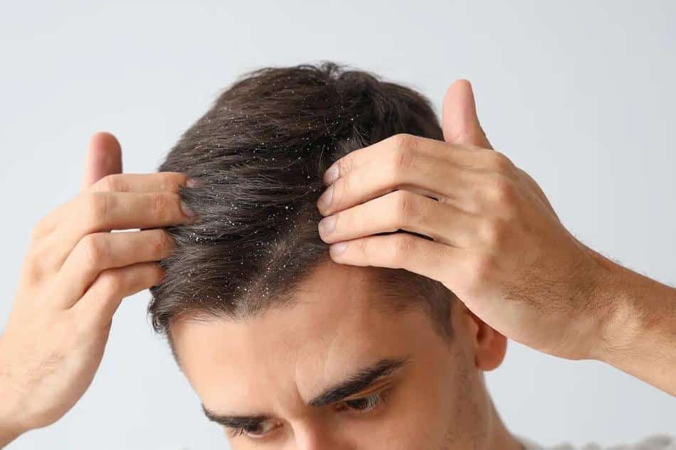 Caspa nervosa: O stress pode agravar a caspa? | Garnier